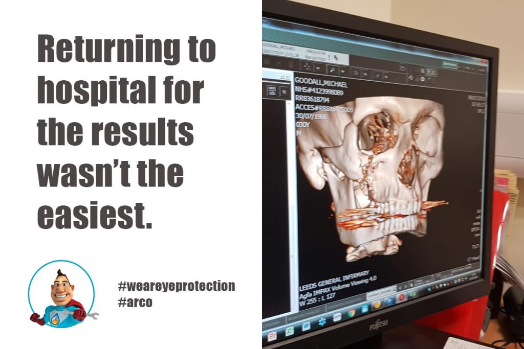 Review Of Arco Safety Glasses - Michael Goodall iPlumb eyesight saved.